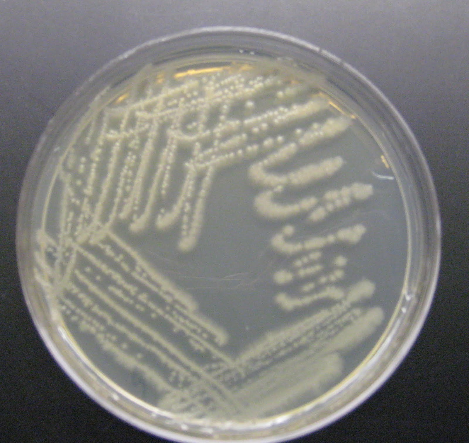 DVC Microbiology 146 Fall 11 (Gard): Lab 7: Colony Morphology