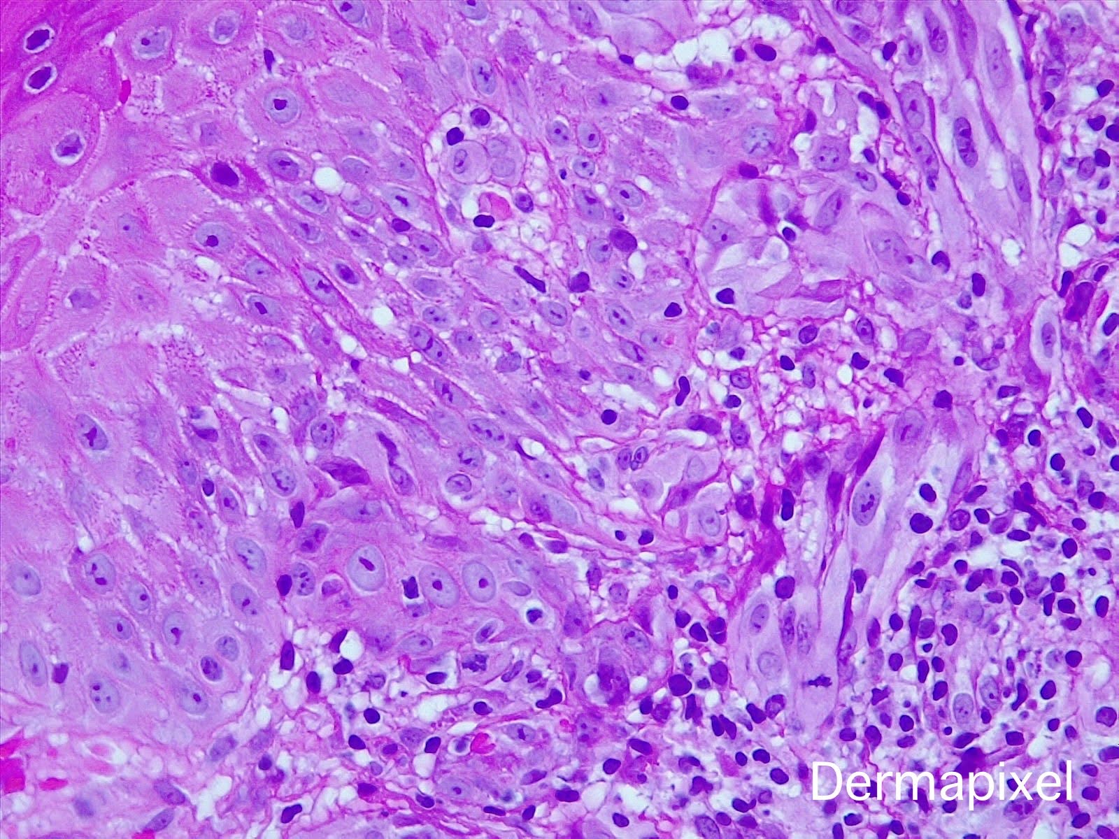 Dermapixel: enero 2021