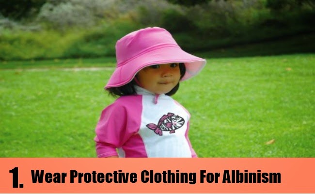 8 Best Natural Cures For Albinism ~ Mzizi Mkavu