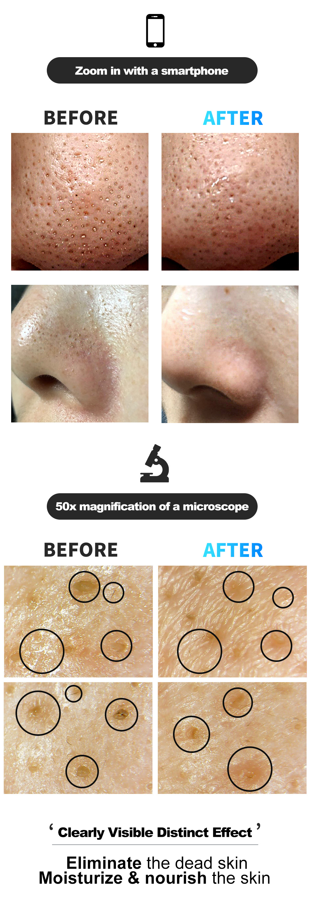 Facial Aqua Peeling Device