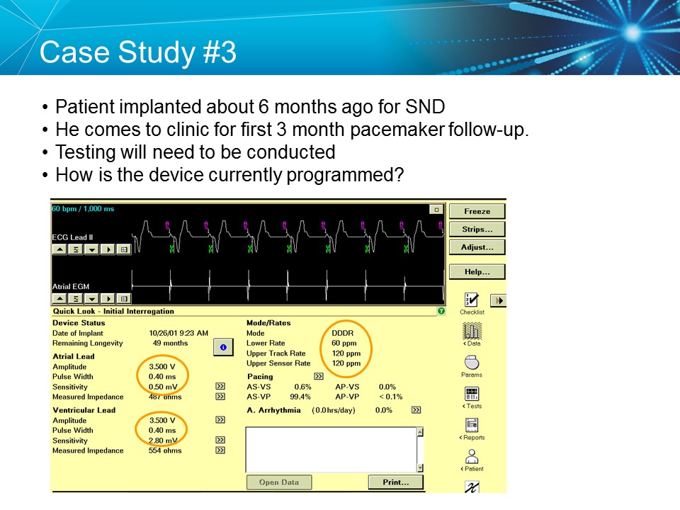 CVT Mohd Farid: Pacemaker Follow Up Part II-Medtronic Academy