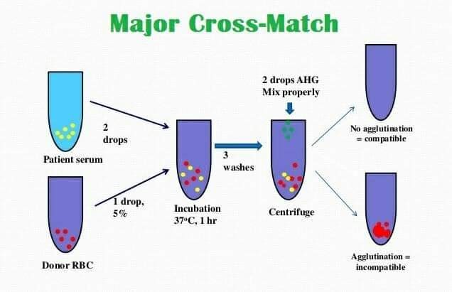 RDK PARAMEDICAL STUDENT STUDY: CROSS MATCHING