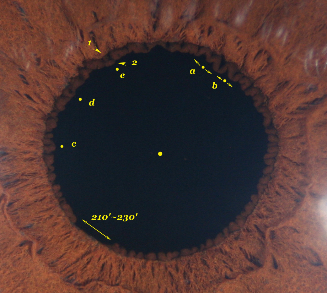 Modern & Multidimensional Iridology: The Pupil, IPB, Pupillary Zone ...