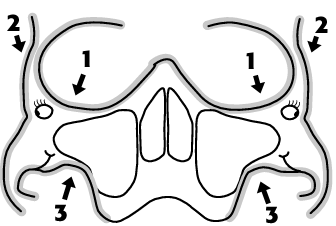 WizDent: Facial and Mandibular Fractures