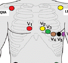 Materi dan Berita Kedokteran: Posisi Pemasangan EKG dan Cara Pemasangan ...