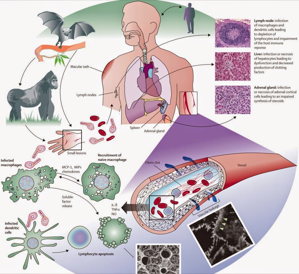 Händler&Helden m.b.H.: Ebola, mehr als ein Outbreak