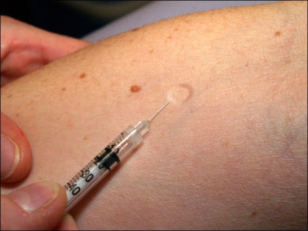 Mateus Felipe : #Compartilhar: Injeções Intradérmica, Subcutânea e ...