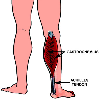 gastrocnemius (muscle)