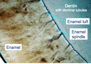 Tooth Enamel- Composition, Properties, Structure and Functions