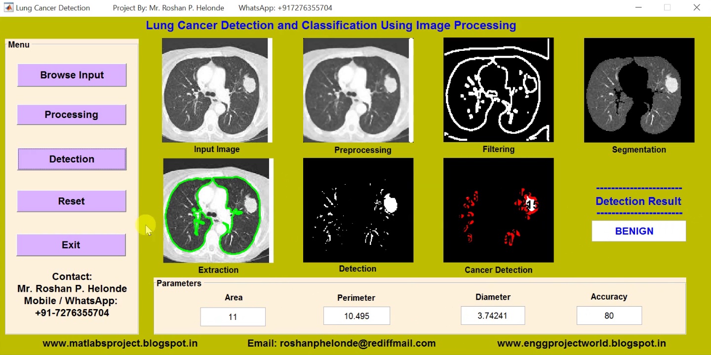 Lung Cancer Detection Using Image Processing Matlab Project Code ~ Matlab Projects