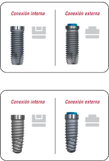 3i Biomet Colombia: Implante NanoTite® - Biomet 3i