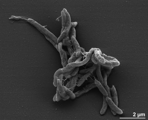 SINTROFISMO: junio 2020