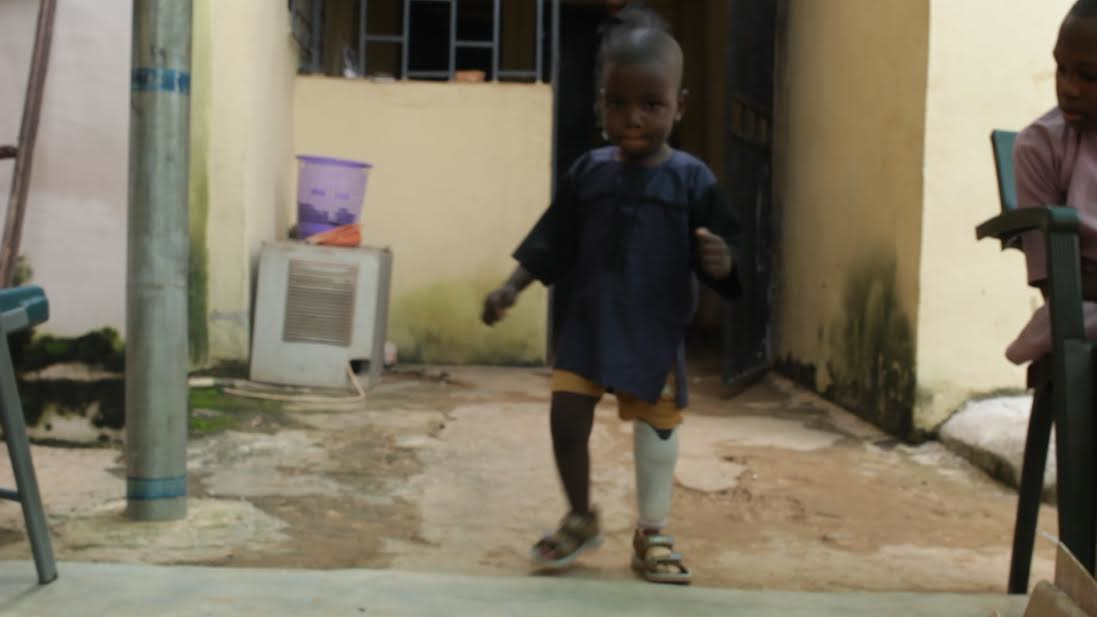 #Together4ALimb by @StanbicIBTC is moving children without limbs forward