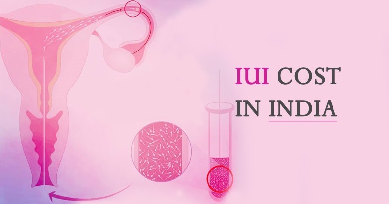 All You Need to Know About IUI Cost in India