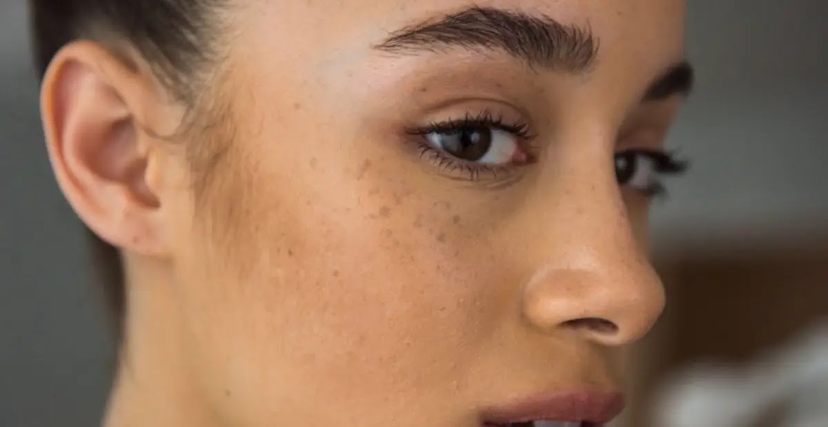 Mengenali Penyebab Wajah Kusam dan Gelap dan Cara Mengatasinya - Tagar ...