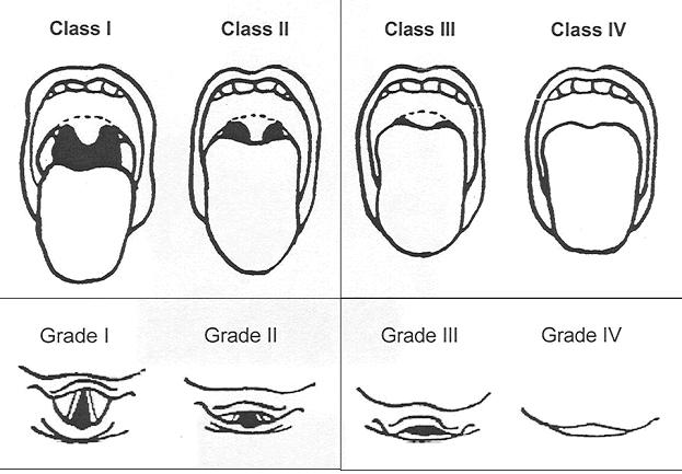 Hauling Humans / A Paramedic's Perspective in a Fire Based EMS System