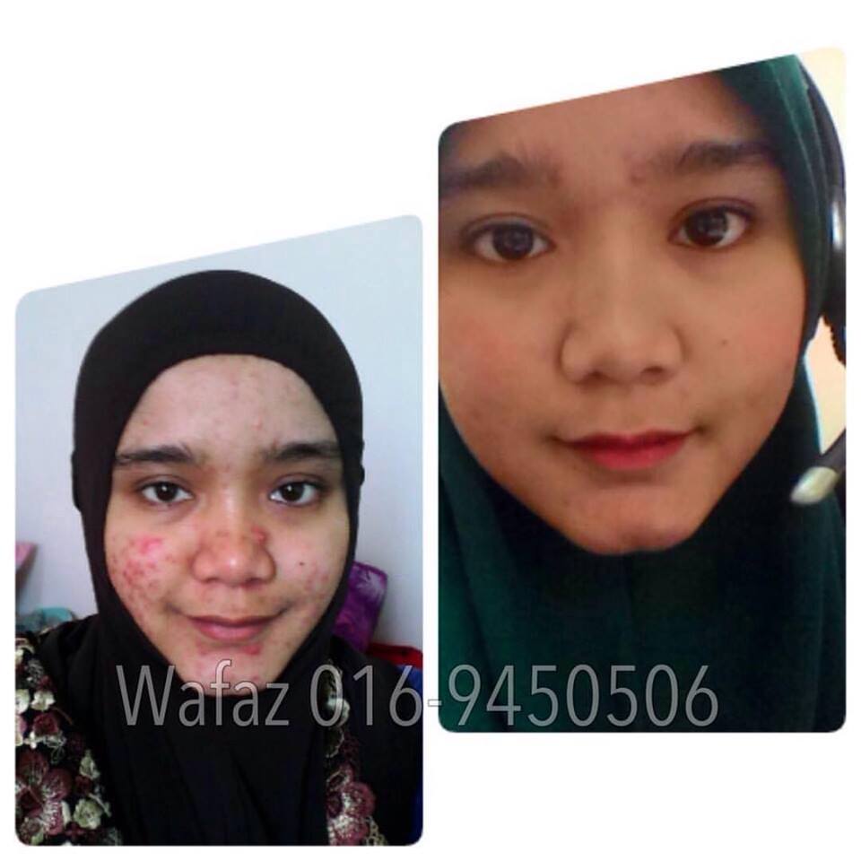 Natural Health Be Young: TESTIMONI YANKO SKINCARE