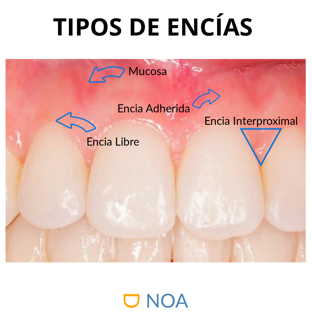 Tipos de Encías