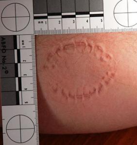 Special Effects - Brave New World: Looking into Human Bite Marks