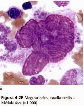 Hematologia: Serie Megacariocítica