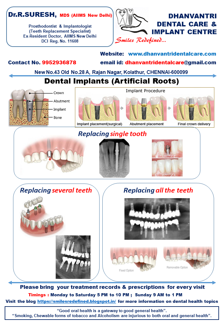 Dental Implants - various treatment options