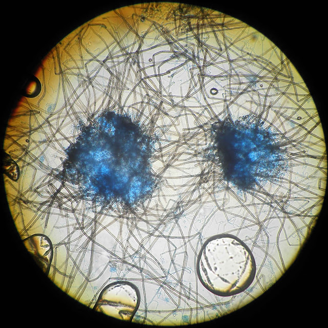 ATLAS MICOLOGIA: CHAETOMIUM SPECIES