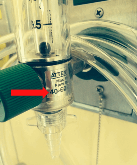 Preoxygenation & apneic oxygenation using a nasal cannula