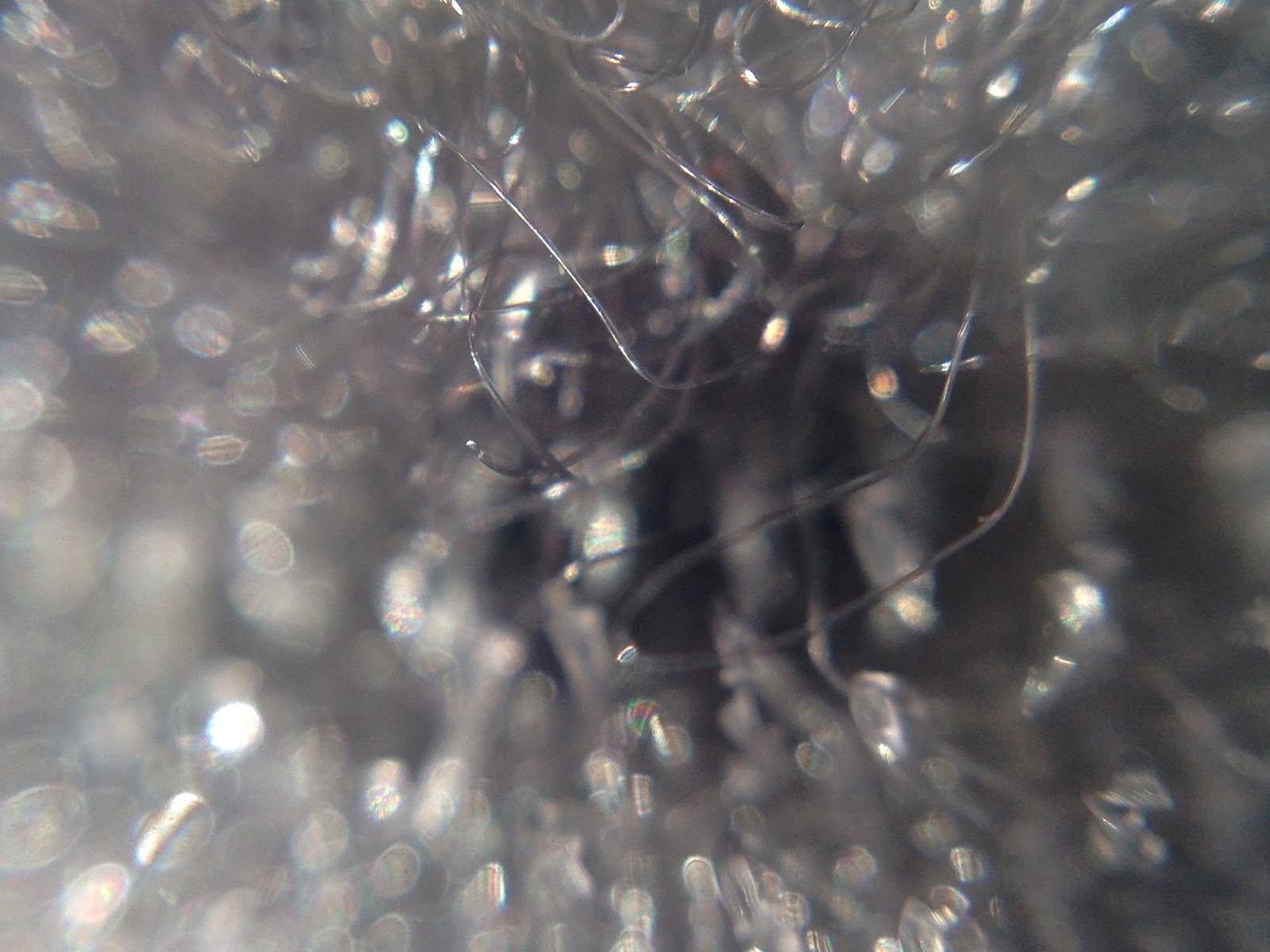 Microscopy-Pictures: Hook-and-pile fastener under the microscope