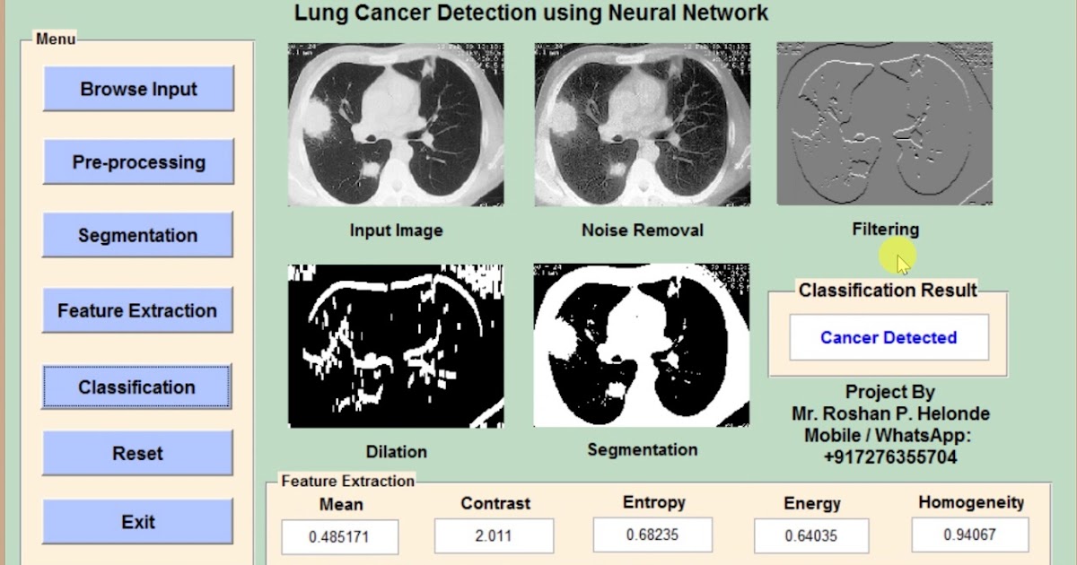 Lung Cancer Detection using Neural Network Matlab Project Source Code ...