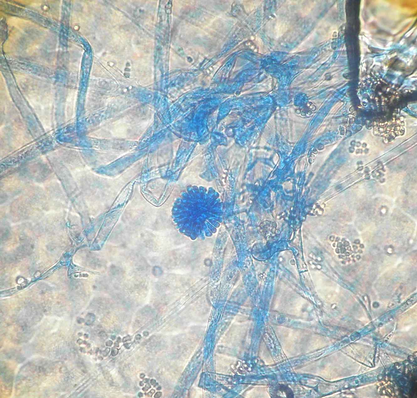 ATLAS MICOLOGIA: SYNCEPHALASTRUM RACEMOSUM