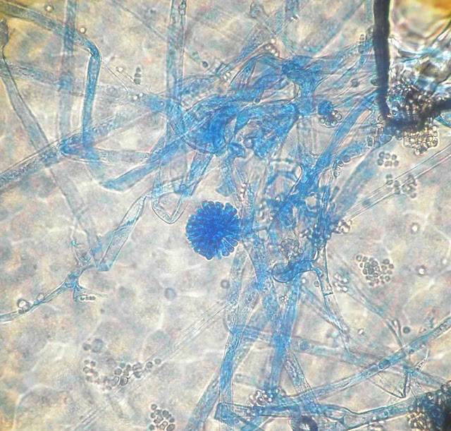 ATLAS MICOLOGIA: SYNCEPHALASTRUM RACEMOSUM