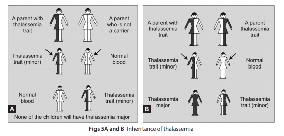 THALASSEMIA -HISTORY AND GENETICS