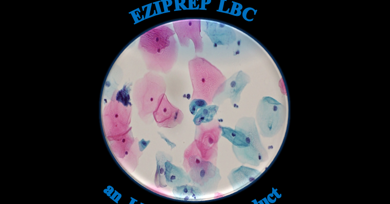 LIQUID BASED CYTOLOGY