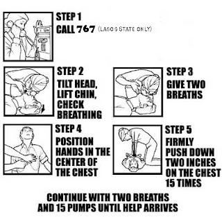 Aunty Nurse: CPR Rescue Breaths (Mouth to Mouth Resuscitation)