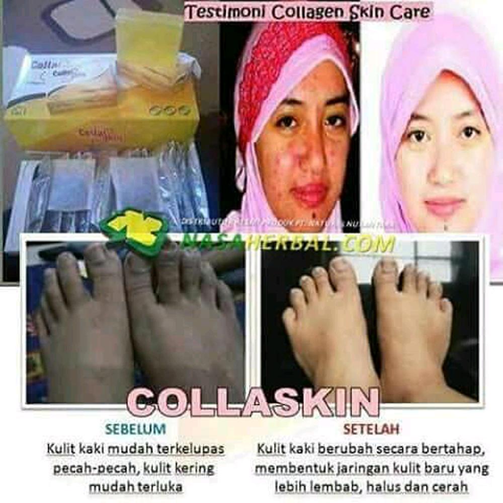 BONUS COLLASKIN CARE (COSKIN) NASA - AGEN-DISTRIBUTOR-NASA RESMI