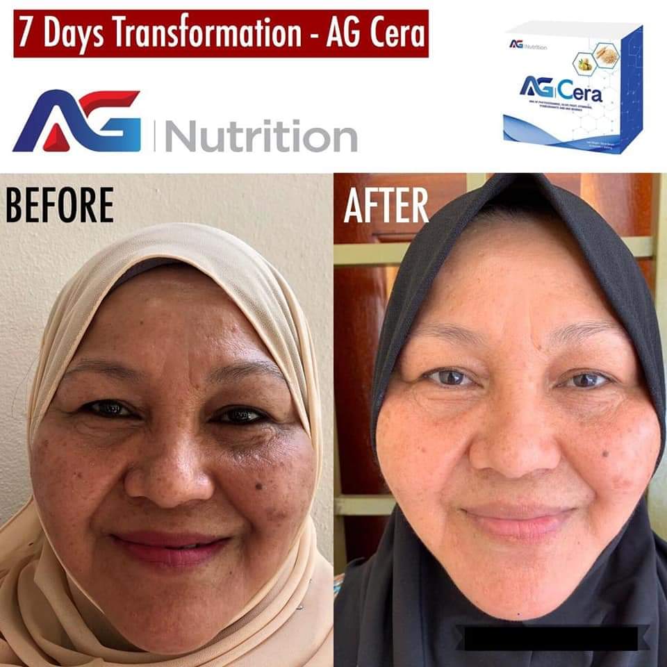 AG CERA | KULIT KEMBALI CERAH MUDA SEPANTAS 7 HARI!
