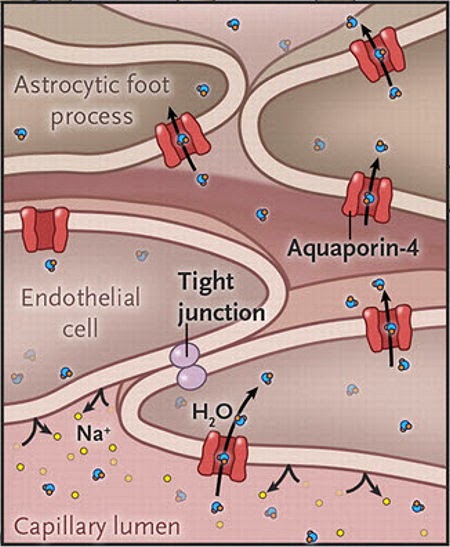 Medical Laboratory and Biomedical Science: Disorders of Plasma Sodium