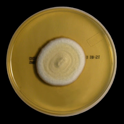 Fun With Microbiology (What's Buggin' You?): Trichophyton ...