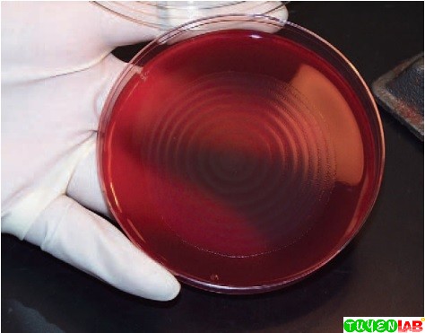 [Microbiology] Atlas of Enterobacteriaceae | Free Medical Atlas