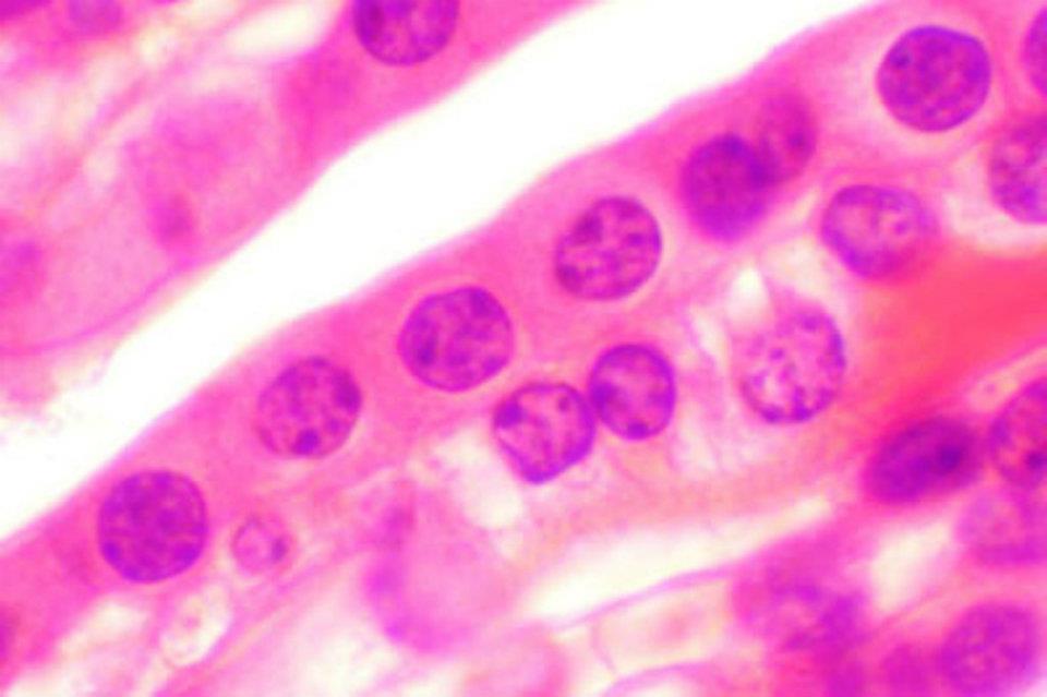Plantão Médico: HISTOLOGÍA TEJIDO EPITELIAL DE REVESTIMIENTO Y GLANDULAR