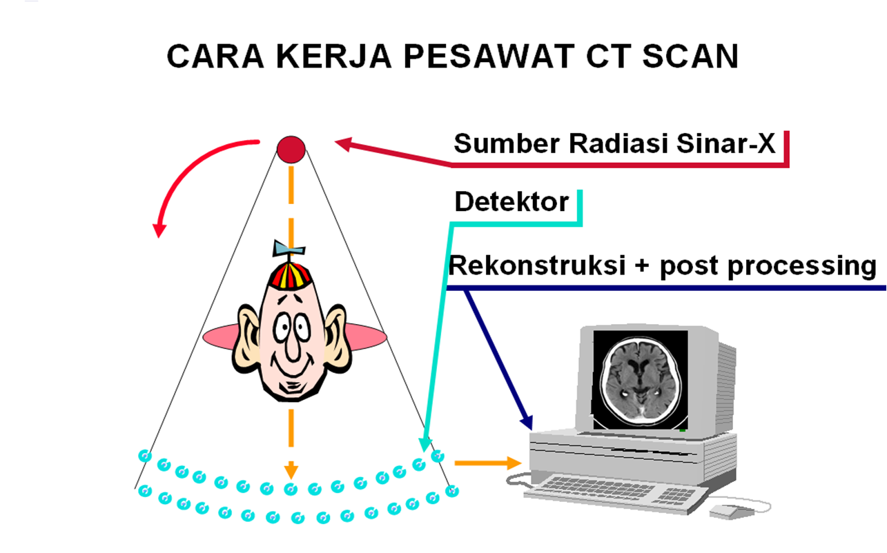 Radiation is my friend: Computed Tomography Scanning (CT Scan)