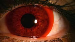 10 Jenis Lensa Kontak Yang Unik Aneh dan Gaul di Dunia ~ Asyik Seru