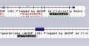 Human Perceptron: ACADM gene and it's disease