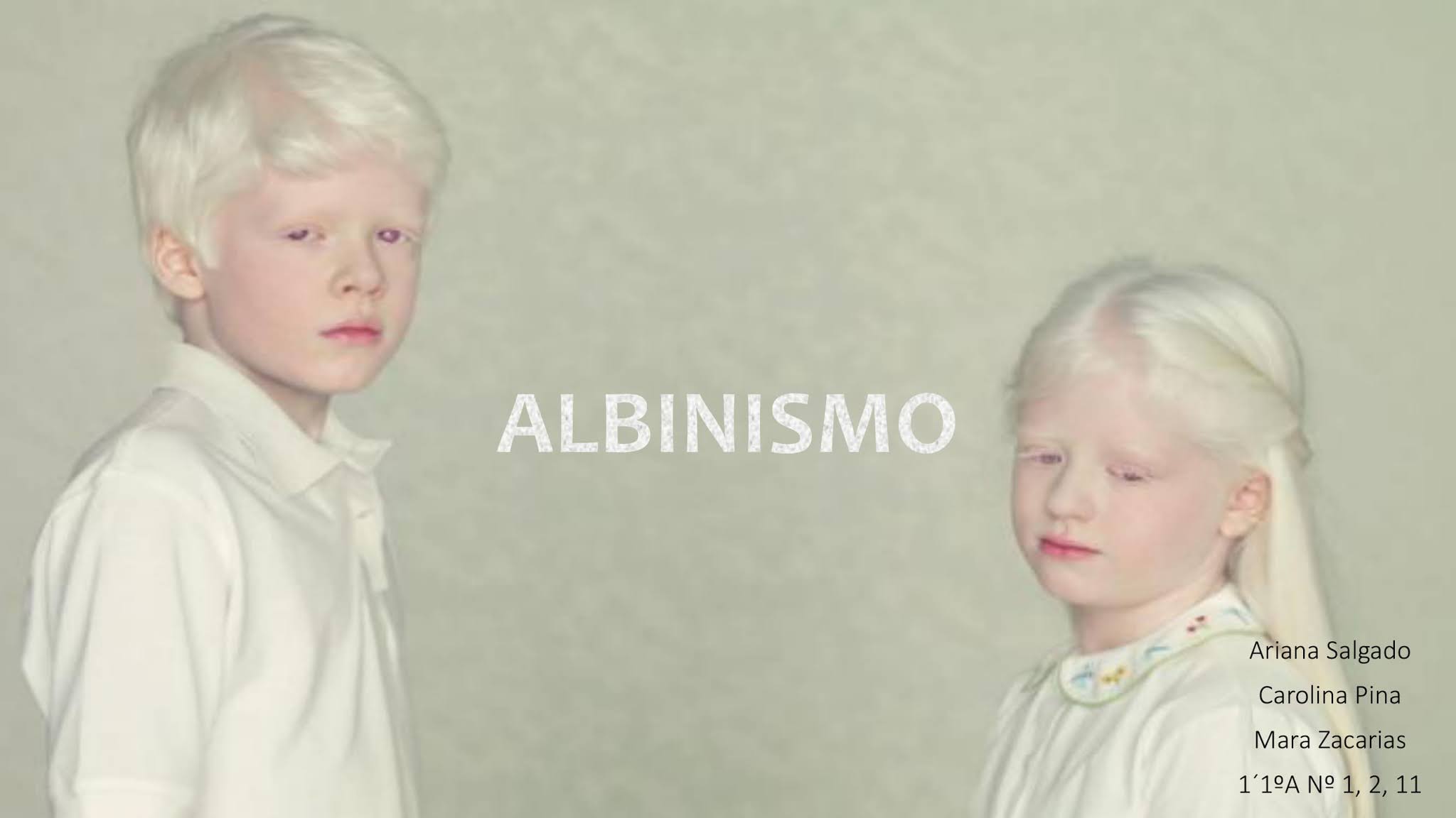 ECB: Mutações Genéticas: o Albinismo - trabalho de alunos do 11º A