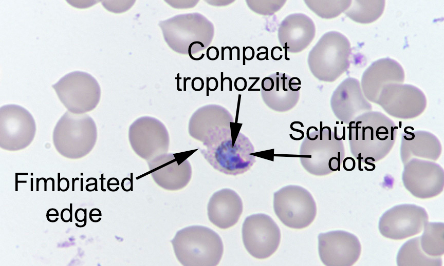 Creepy Dreadful Wonderful Parasites: Answer to Case 564