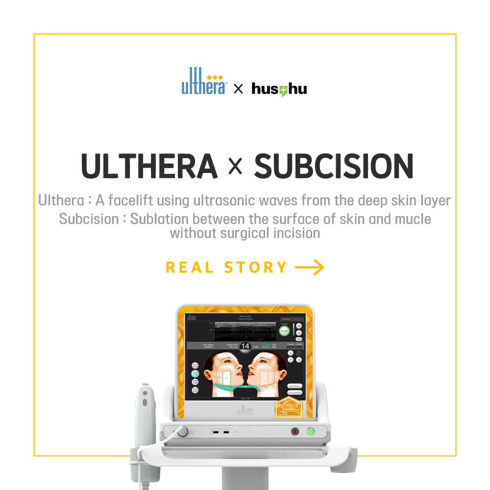 Hushu Dermatology: Mid Cheek Groove treatment-Real Story