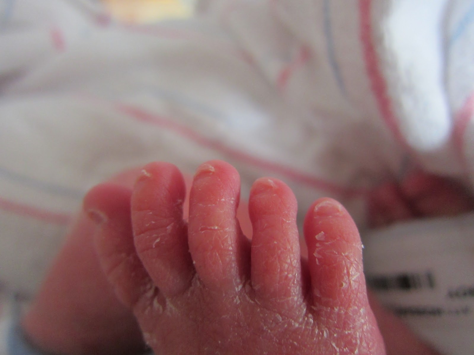 Raymond Family Blog: The cutest toes I've ever seen