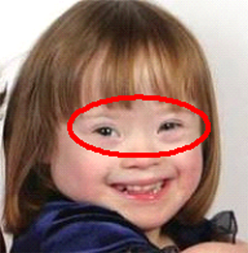 The Autism Speaks: MENGENALI CIRI – CIRI ANAK AUTIS ATAU DOWN SYNDROME