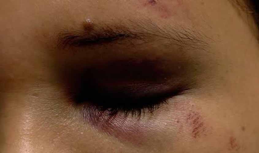 Homem dá soco no rosto da esposa adolescente por ciúmes do vestido que ...