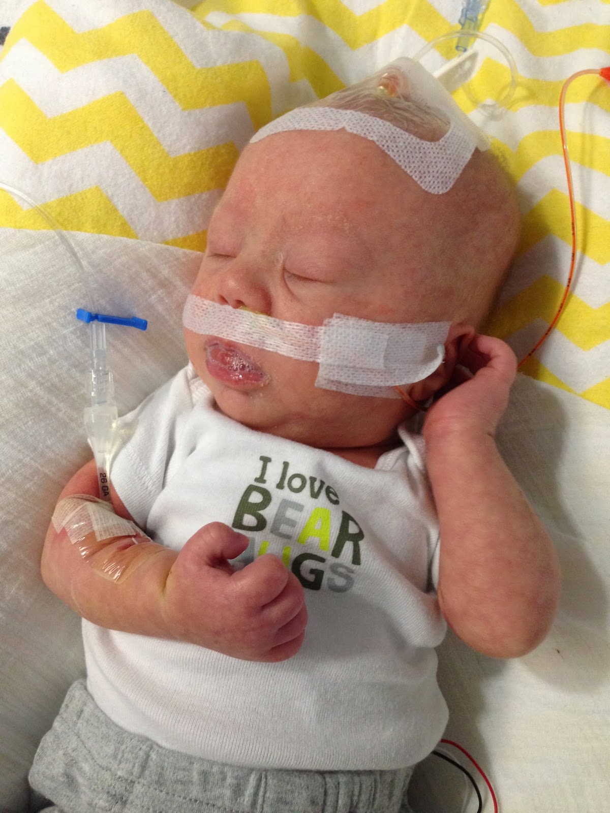 In His Hands: First Days in the PICU